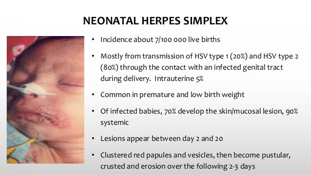 Common skin conditions in neonates