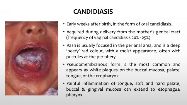 Common skin conditions in neonates