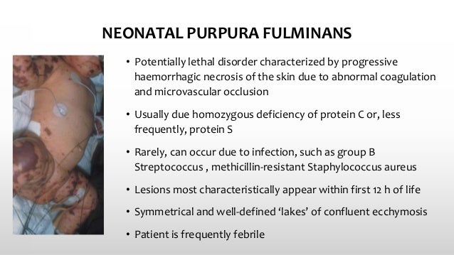Common skin conditions in neonates