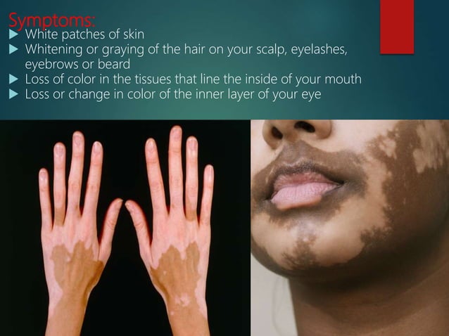 Common Skin Diseases | PPT