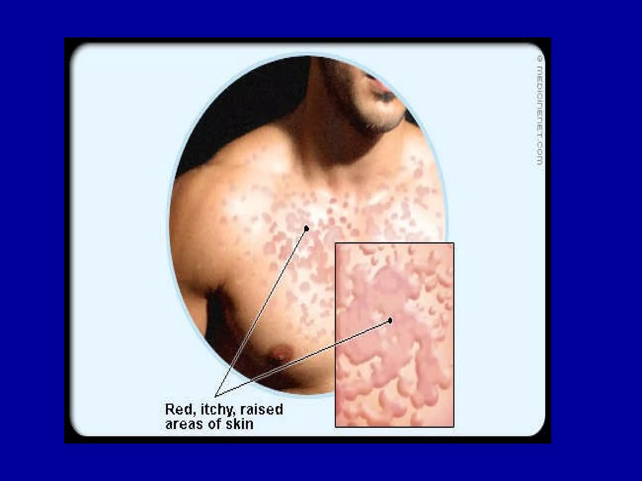 Common skin diseases | PPT