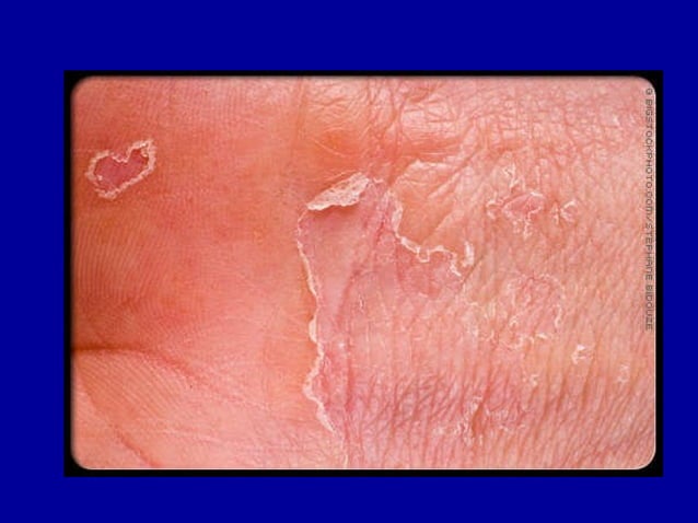 Common skin diseases | PPT | Skin and Dermatology | Diseases and Conditions