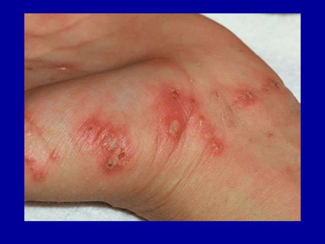 Common skin diseases | PPT | Skin and Dermatology | Diseases and Conditions