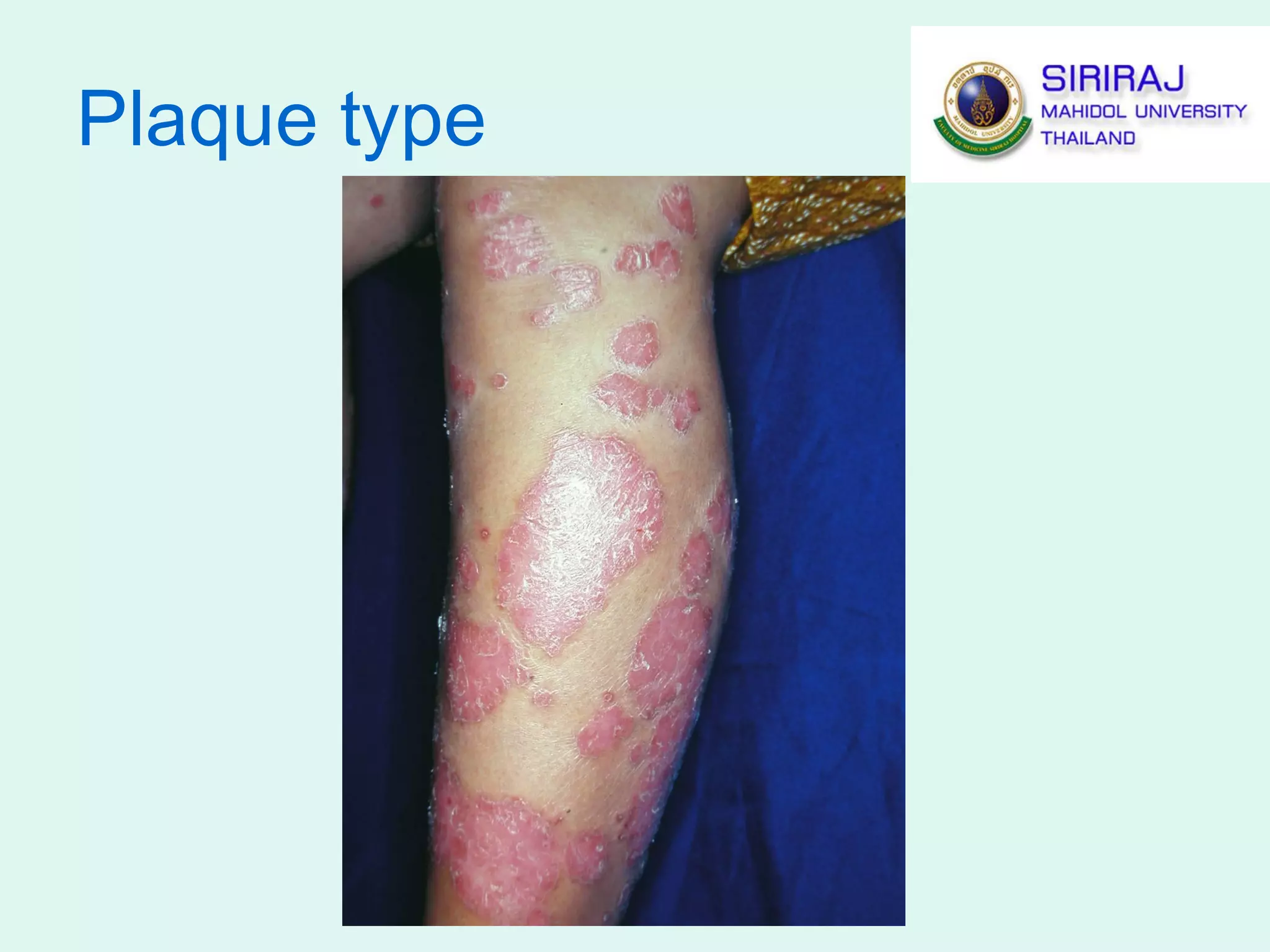 Common skin diseases | PDF