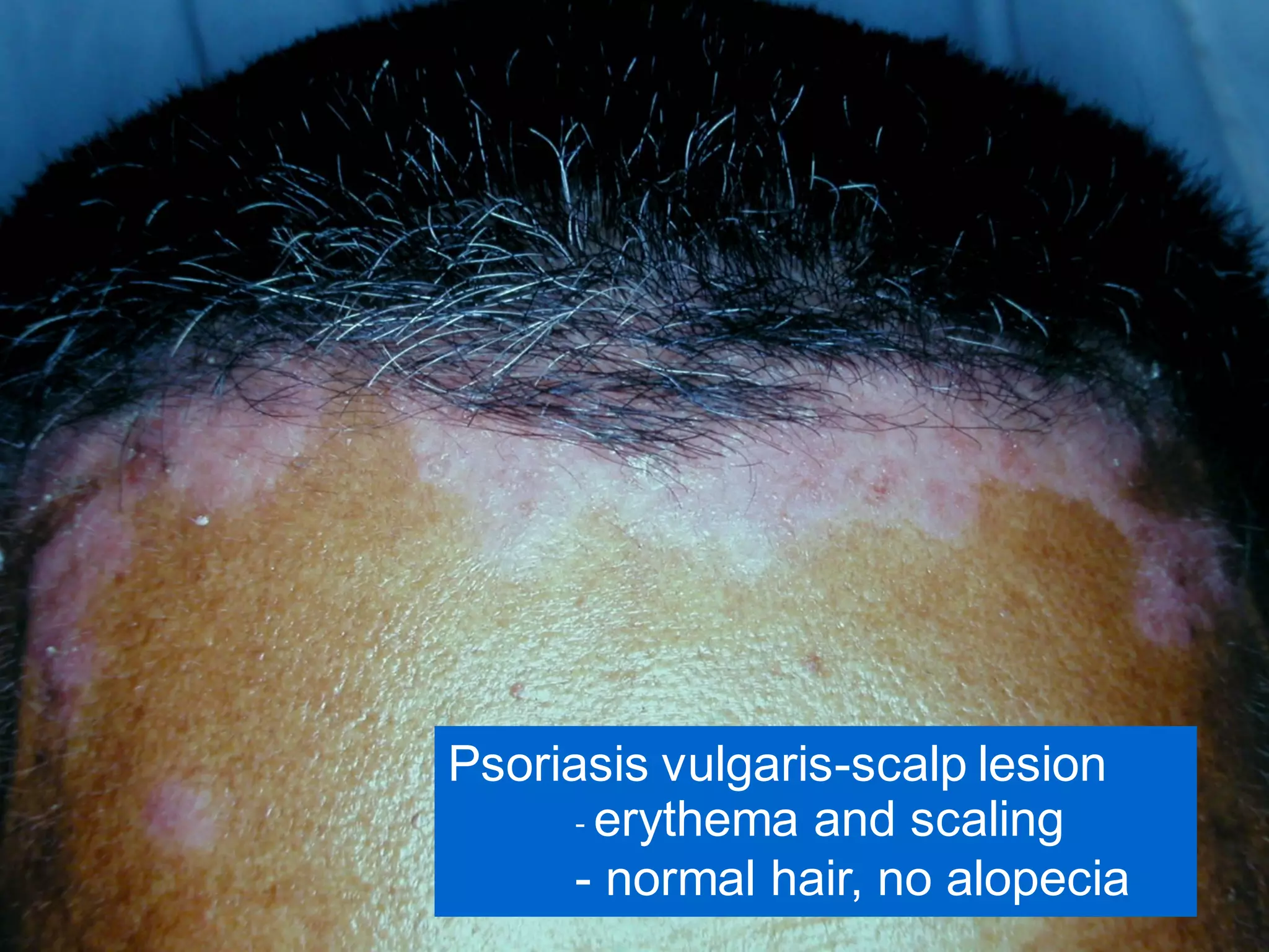 Common skin diseases | PDF