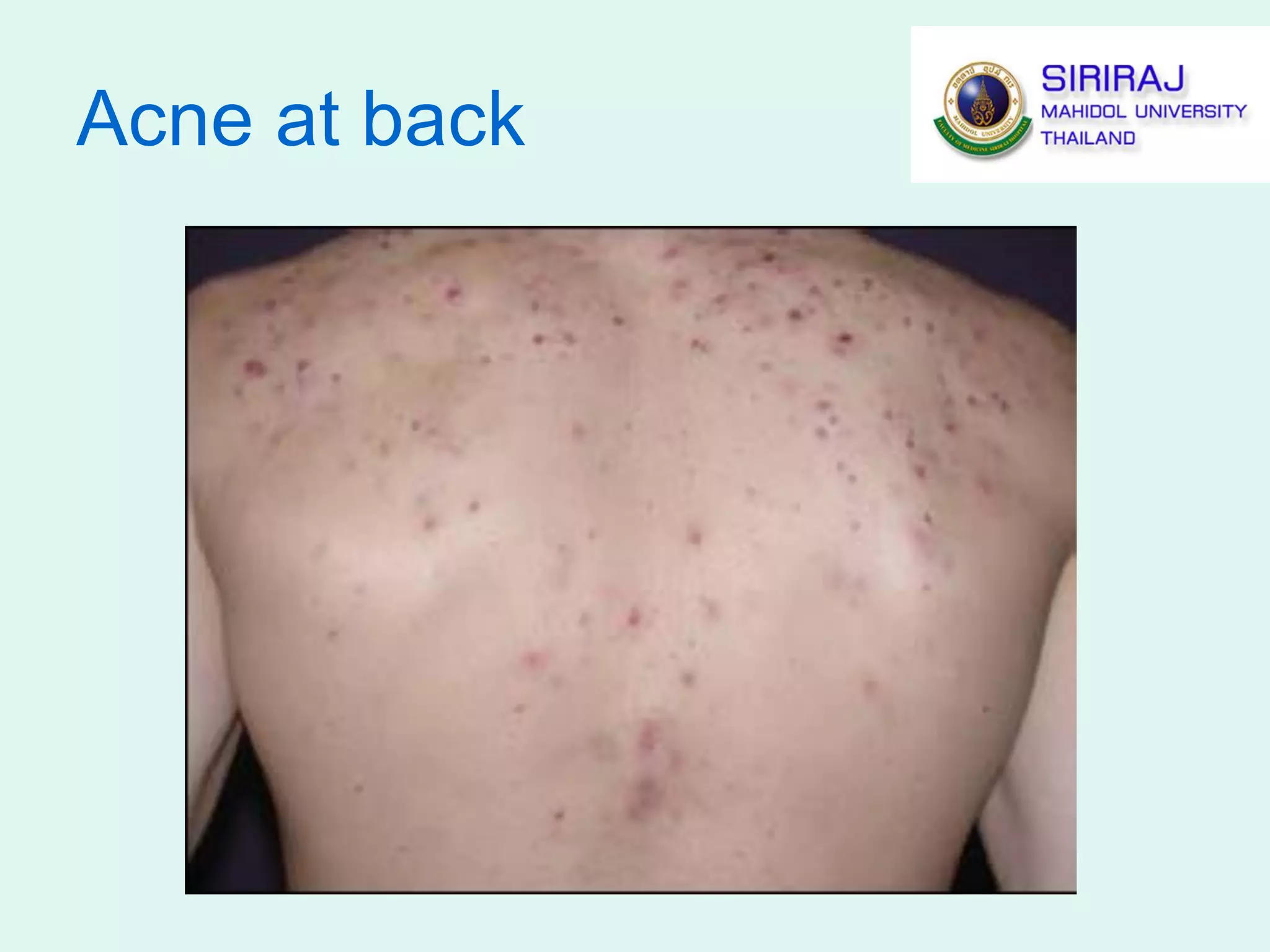 Common skin diseases | PDF | Skin and Dermatology | Diseases and Conditions