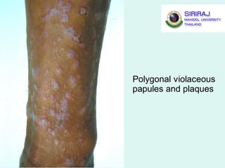 Common skin diseases | PDF