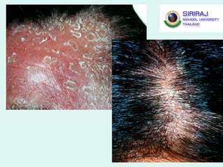 Common skin diseases | PDF