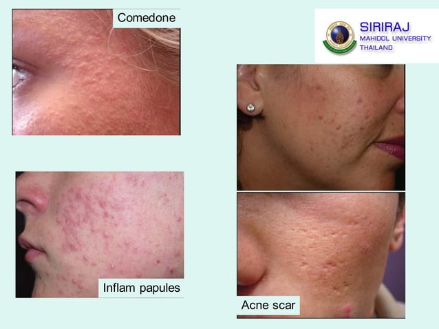 Common skin diseases | PDF | Skin and Dermatology | Diseases and Conditions