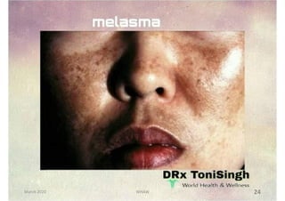 Most Common skin diseases drx_tonisingh | PPT