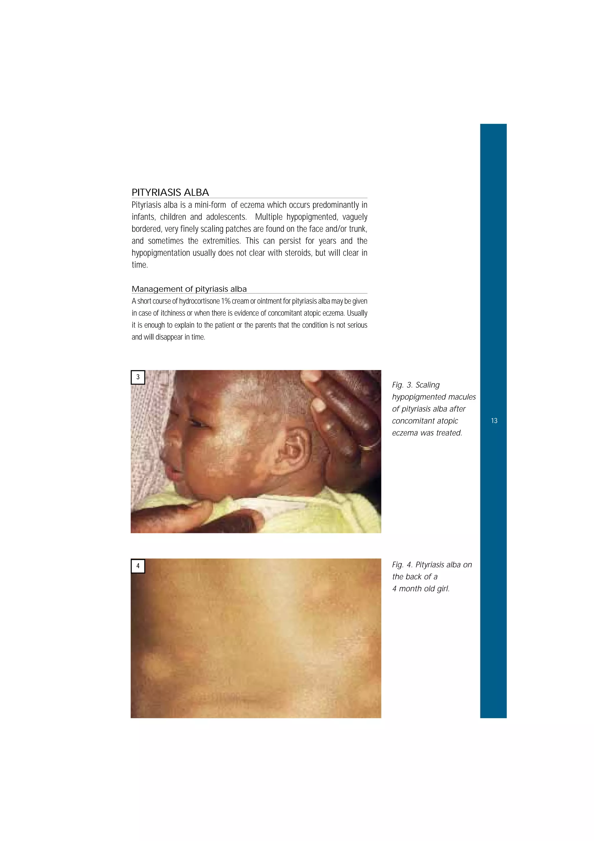 Common Skin Diseases in Africa Illustrated Guide 2001.pdf