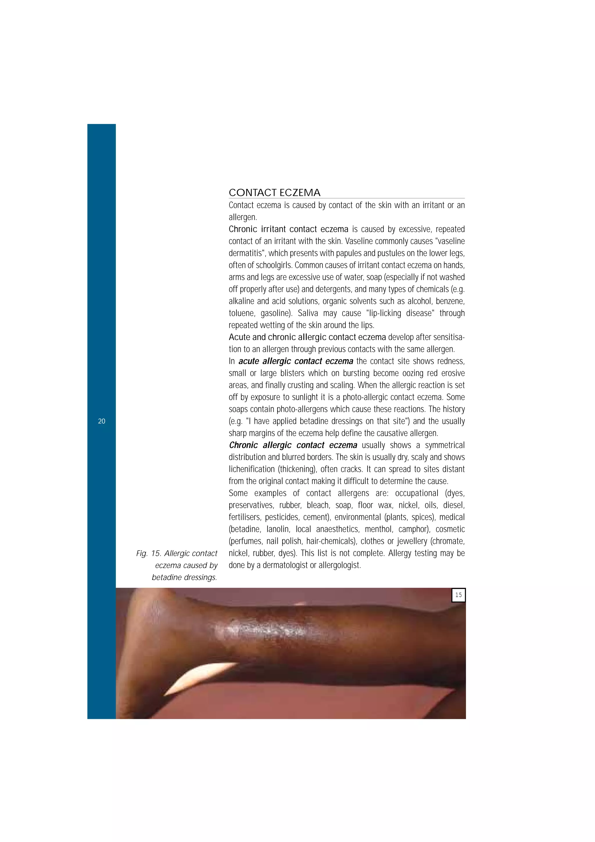 Common Skin Diseases in Africa Illustrated Guide 2001.pdf