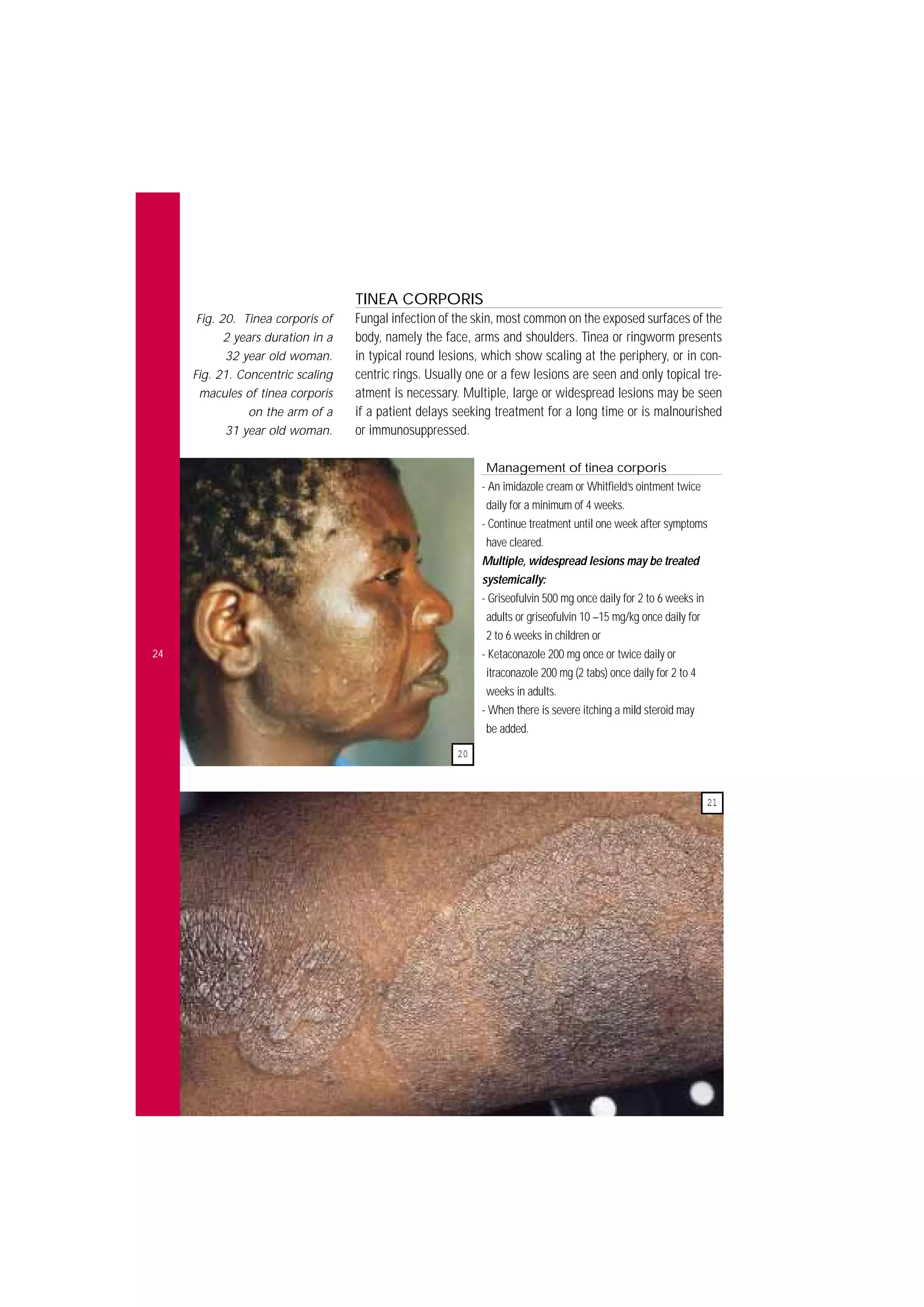 Common Skin Diseases in Africa Illustrated Guide 2001.pdf