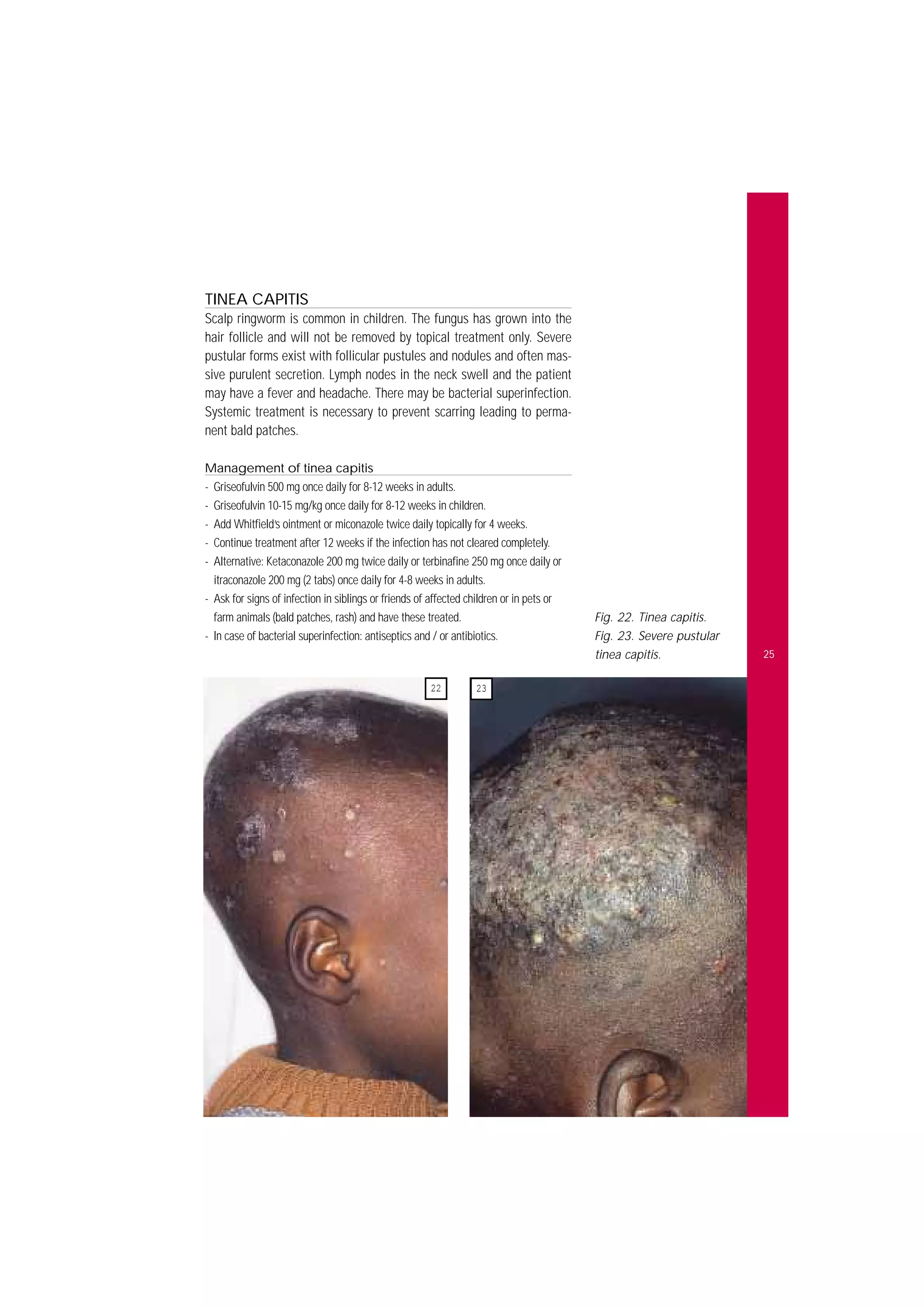 Common Skin Diseases in Africa Illustrated Guide 2001.pdf