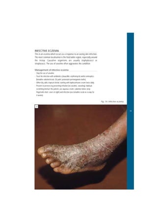 Common Skin Diseases in Africa Illustrated Guide 2001.pdf