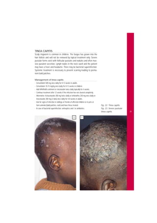 Common Skin Diseases in Africa Illustrated Guide 2001.pdf