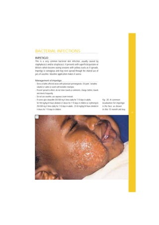 Common Skin Diseases in Africa Illustrated Guide 2001.pdf