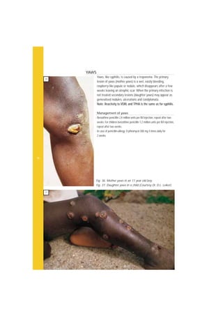 Common Skin Diseases in Africa Illustrated Guide 2001.pdf