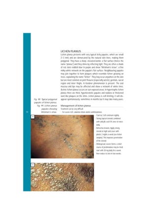 Common Skin Diseases in Africa Illustrated Guide 2001.pdf