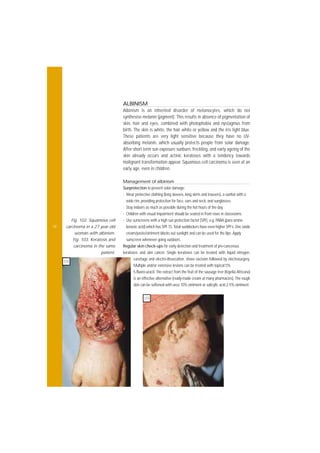 Common Skin Diseases in Africa Illustrated Guide 2001.pdf