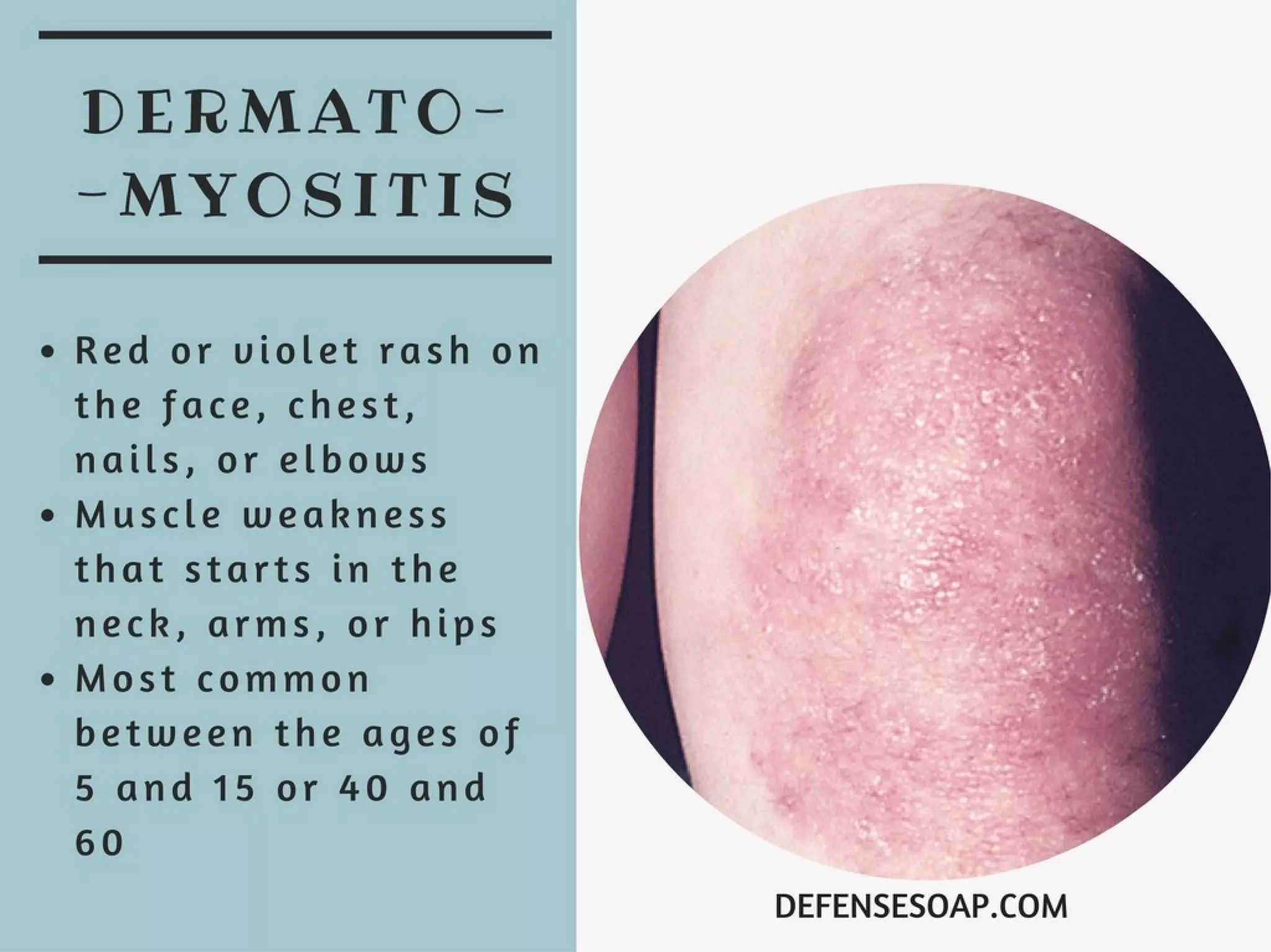 Common Skin Disorders | ODP