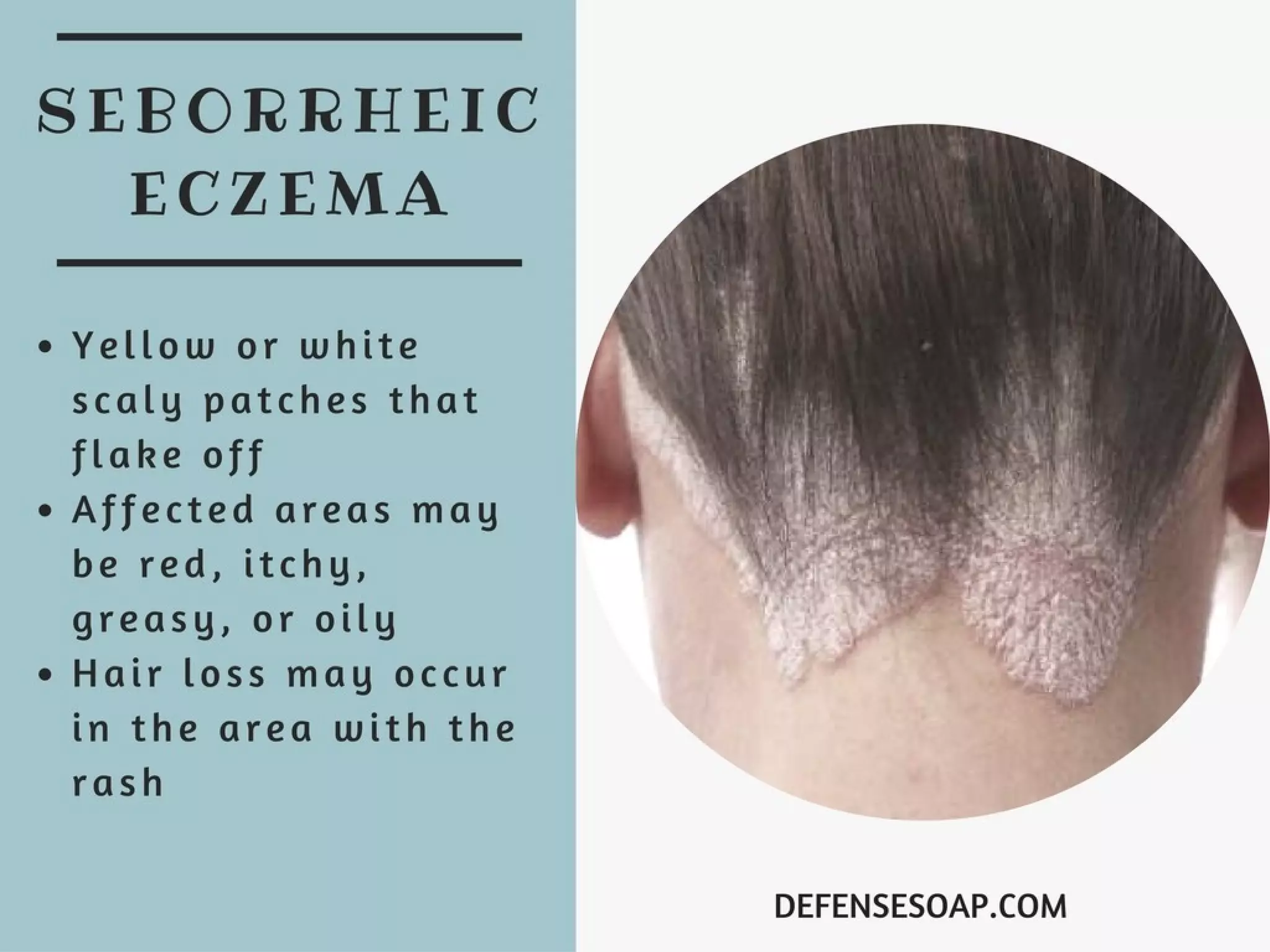 Common Skin Disorders | ODP