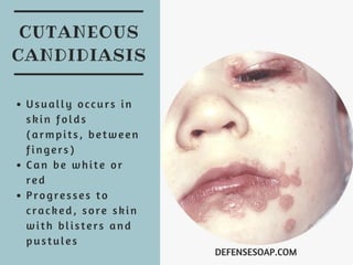 Common Skin Disorders | ODP