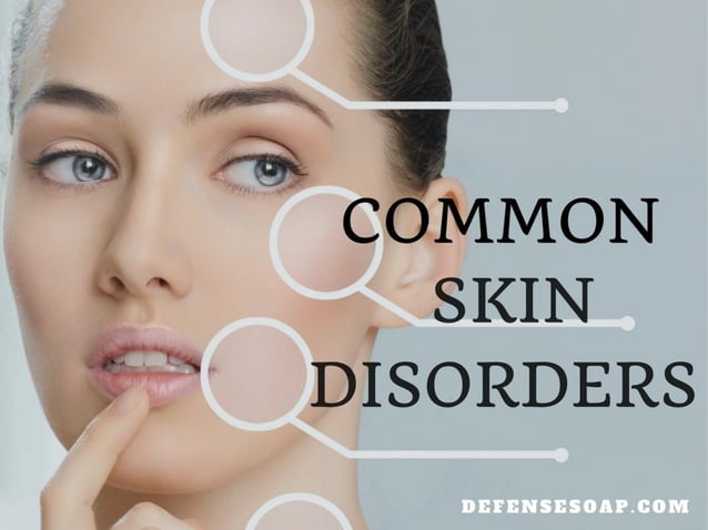 Common Skin Disorders | PPT