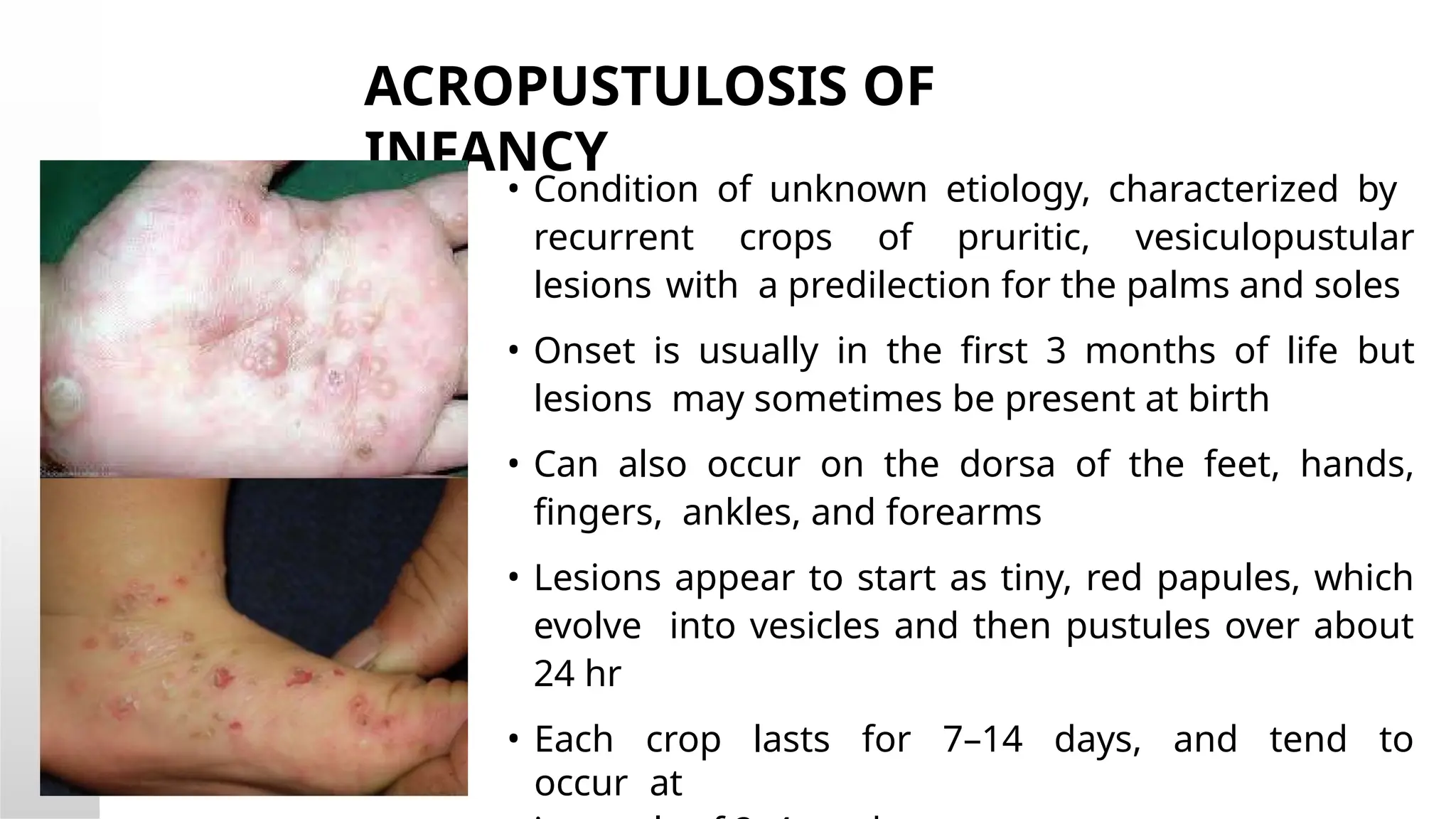Common Skin Disorders in childrenpresentation | PPTX