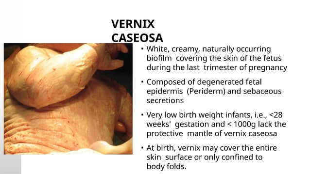 Common Skin Disorders in childrenpresentation | PPT