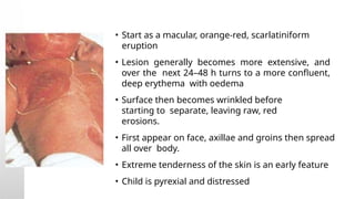 Common Skin Disorders in childrenpresentation | PPTX