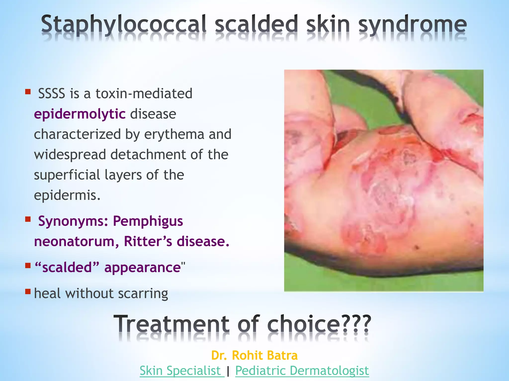 Common Skin Infections in Children | PPTX