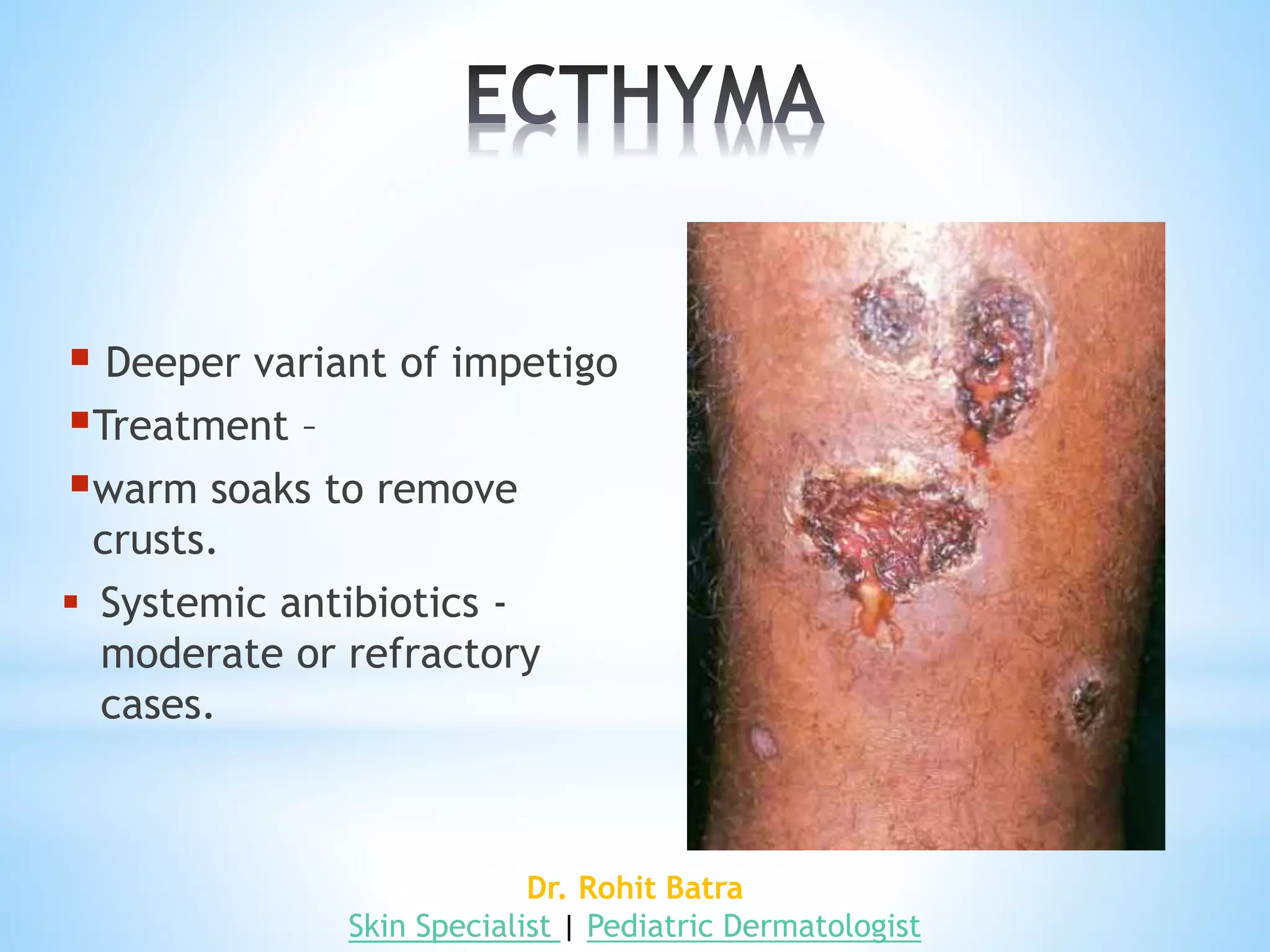 Common Skin Infections in Children | PPTX