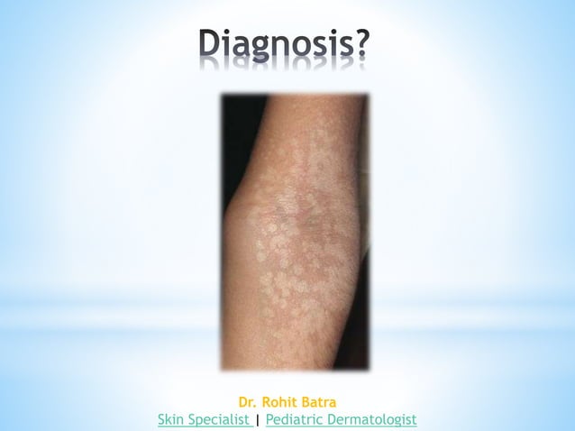 Common Skin Infections in Children | PPTX | Skin Care | Beauty