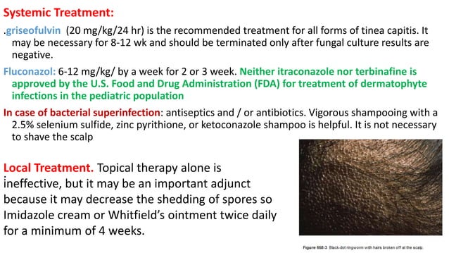 COMMON SKIN INFECTIONS IN CHILDREN.pptx | Skin and Dermatology ...