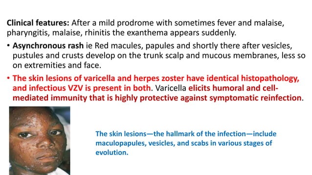 COMMON SKIN INFECTIONS IN CHILDREN.pptx | Skin and Dermatology ...