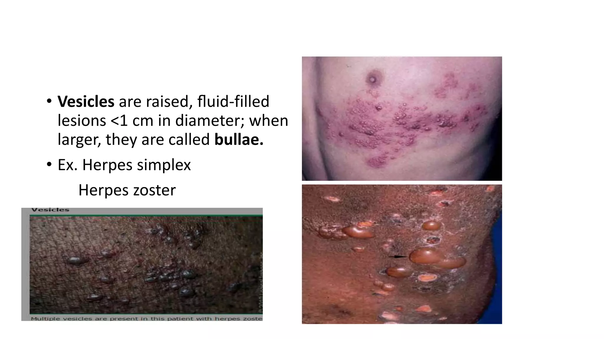 Common Skin Lesions in Pediatrics.pptx | Skin and Dermatology ...