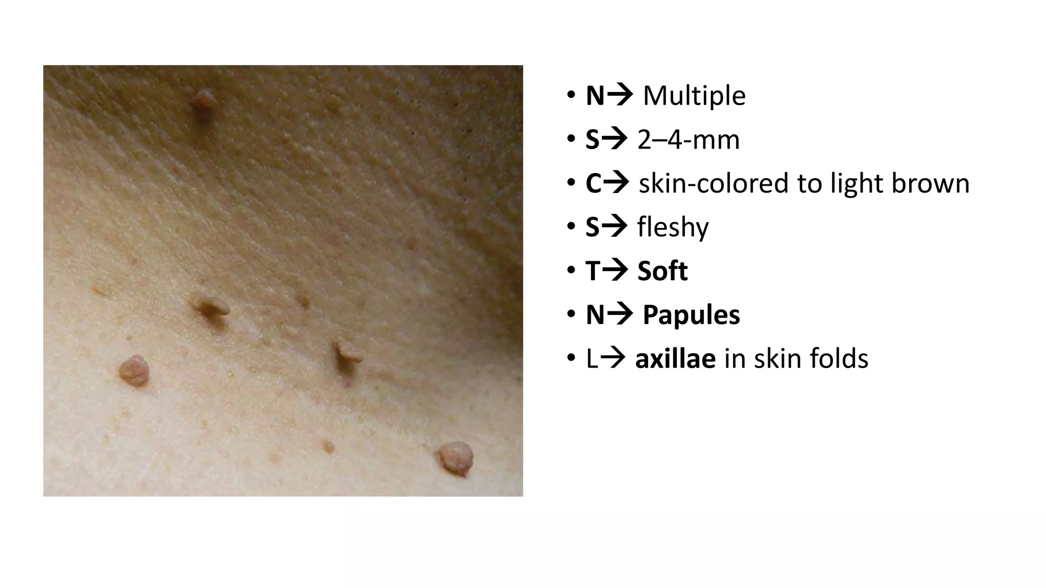 Common Skin Lesions in Pediatrics.pptx