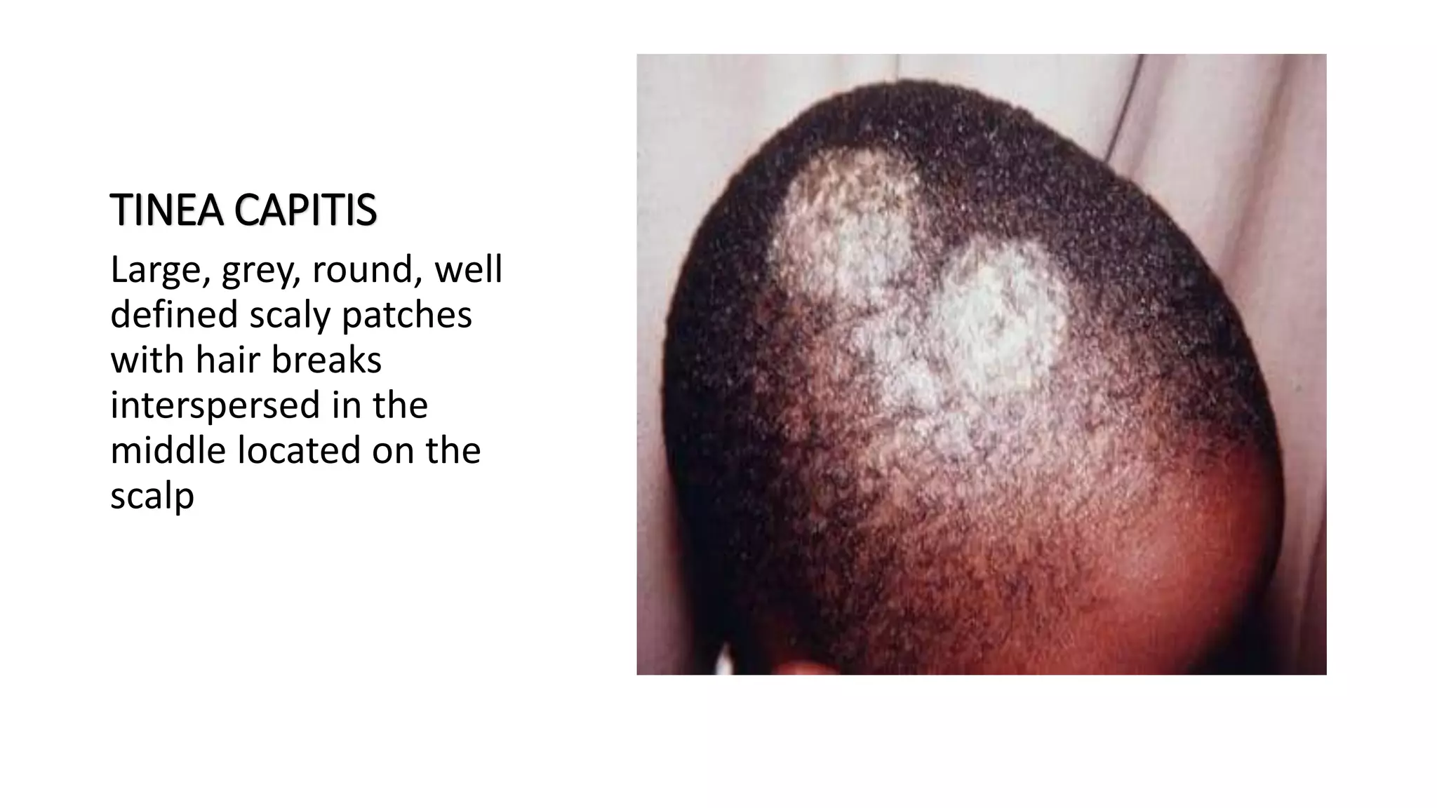 Common Skin Lesions in Pediatrics.pptx