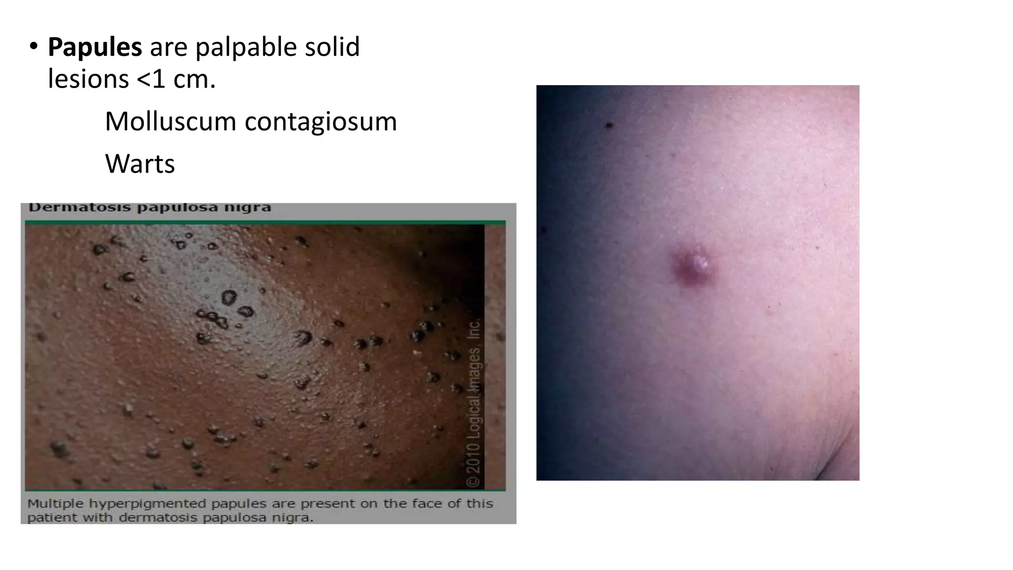 Common Skin Lesions in Pediatrics.pptx
