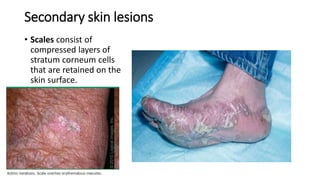 Common Skin Lesions in Pediatrics.pptx