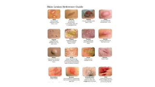 Common Skin Lesions in Pediatrics.pptx