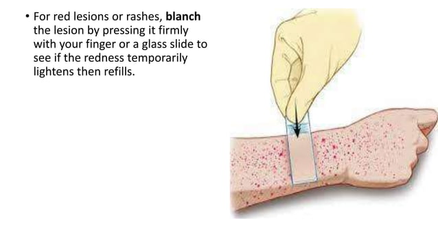 Common Skin Lesions in Pediatrics.pptx | Skin and Dermatology ...