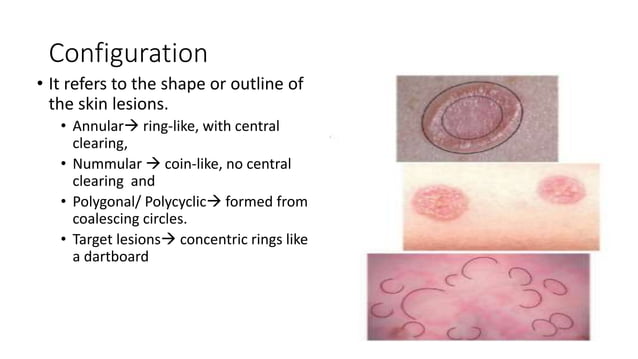Common Skin Lesions in Pediatrics.pptx | Skin and Dermatology ...