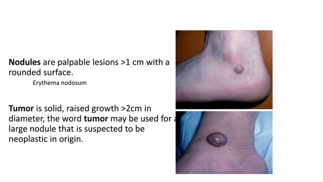Common Skin Lesions in Pediatrics.pptx | Skin and Dermatology ...