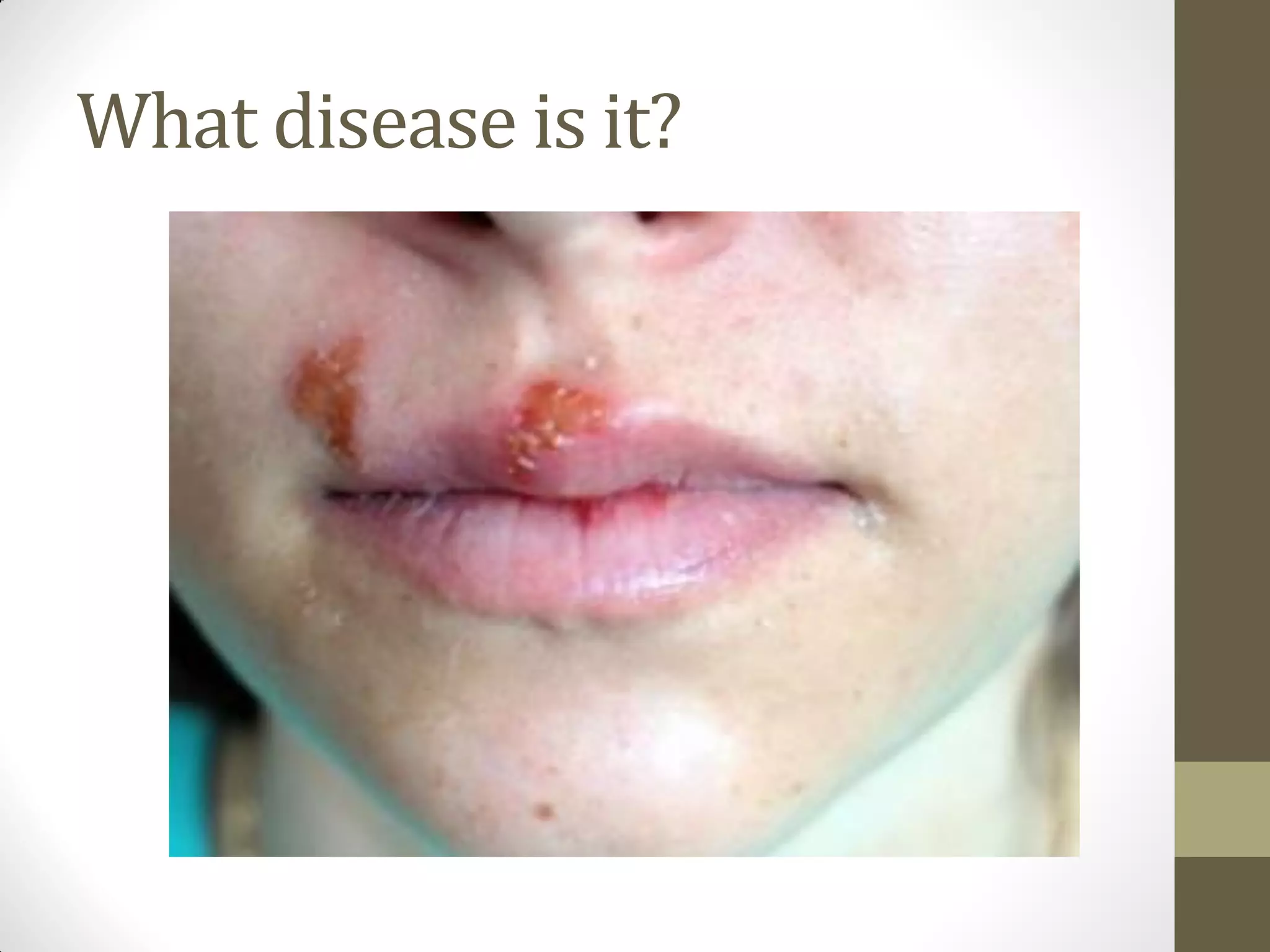 Common skin problem postest | PDF