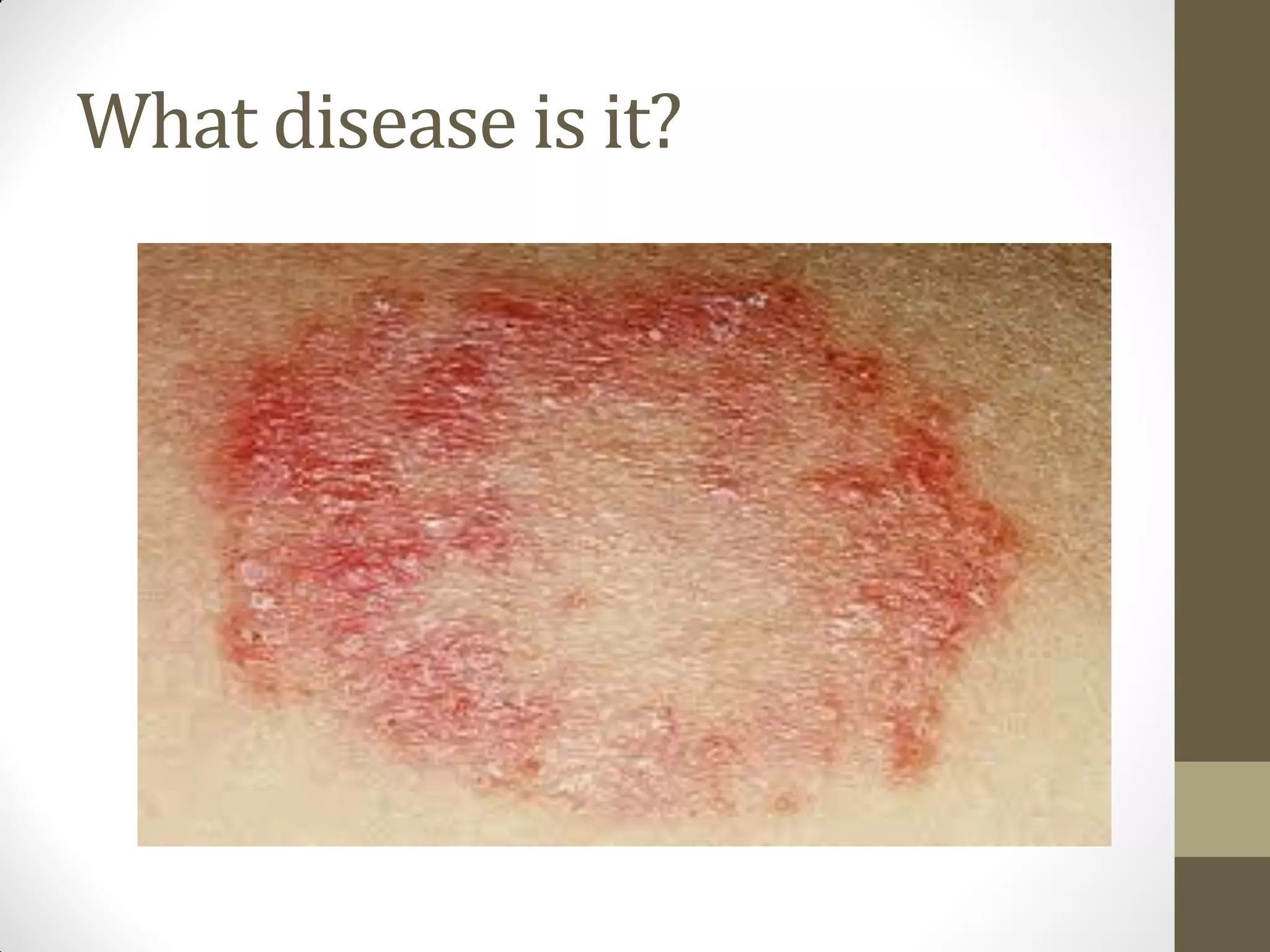 Common skin problem postest | PDF