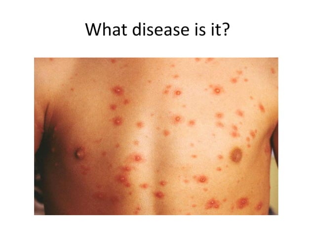 Common skin problem pretest | PDF | Skin and Dermatology | Diseases and ...