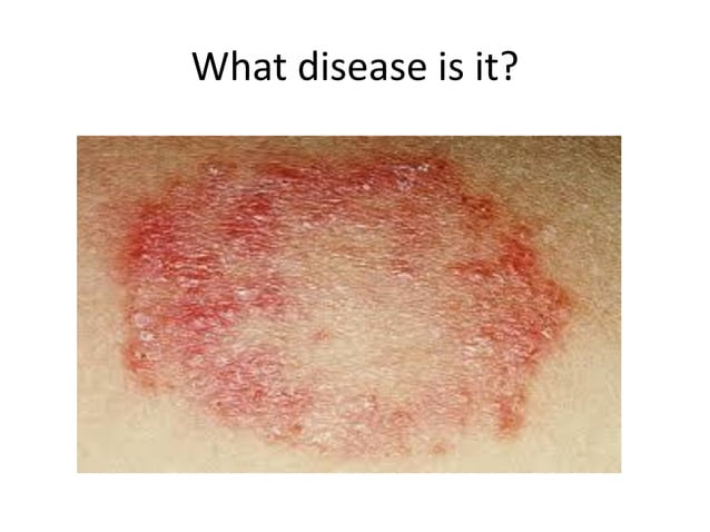 Common skin problem pretest | PDF | Skin and Dermatology | Diseases and ...
