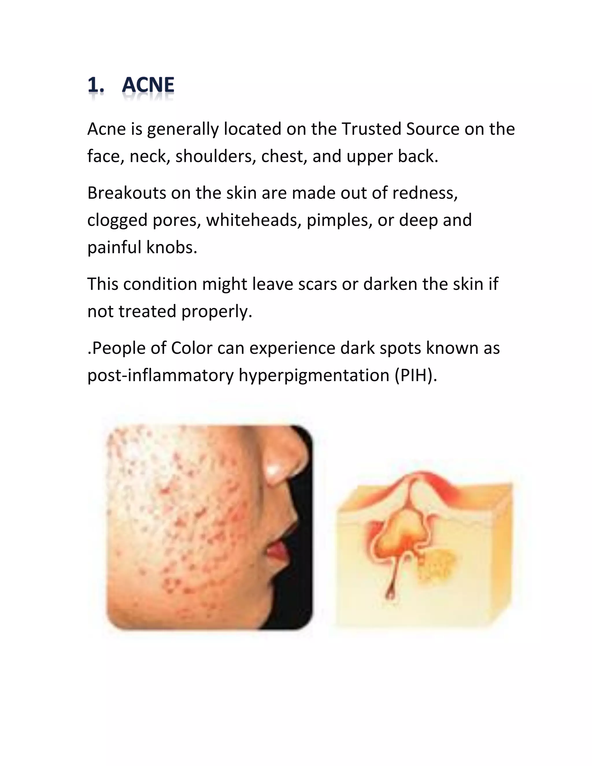Common Skin Problems and their solutions for healthy skin.pdf